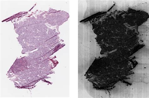 [논문 리뷰] open source framework for detecting bias and overfitting for large pathology images