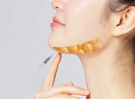 Contour Injection Ab Clinic