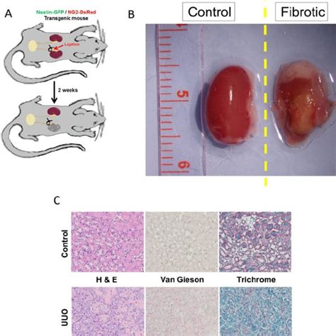Mouse Model Of Myocardial Infarction Schematic Illustration Of My XXX Hot Girl
