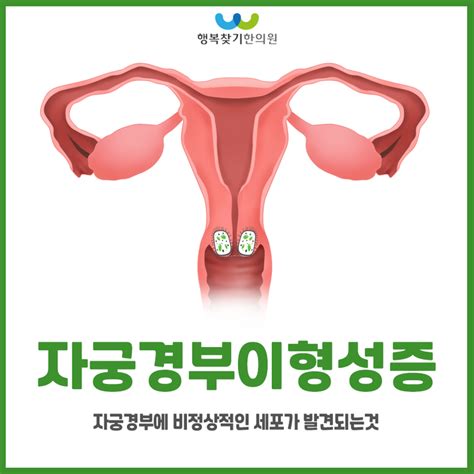 자궁경부이형성증 어떻게 치료하나요 네이버 블로그