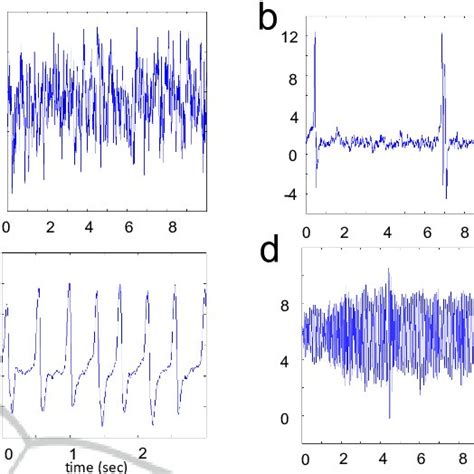 Various EEG Patterns Produced By The Multi Area Model A Background Download Scientific