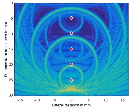 Ultrasonic Waves Envelope Propagating Downwards Focused At 35 Mm And