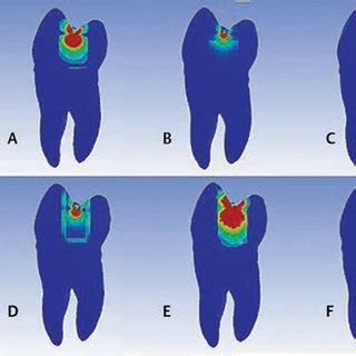 Finite Element Analysis Model 1 Model 2 Model 3 Download Scientific Diagram
