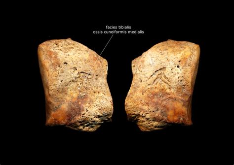 Os Cuneiforme Mediale Kost Klínová Mediální Ossa Membri Inferioris