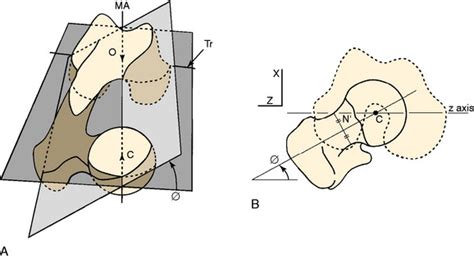 Patellofemoral Disorders Correction Of Rotational Malalignment Of The