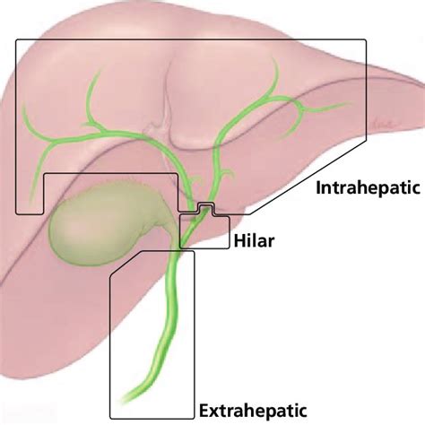 Classification Of Cholangiocarcinoma Download Scientific Diagram