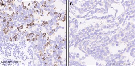 Anti Alpha 1 Adrenergic Receptor Antibody [epr27512 50] Ab313577 Abcam