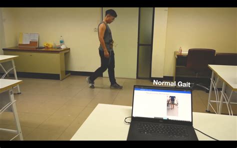 Iot Based Wearable Device Offers Affordable And Portable Gait Analysis For The Early Detection