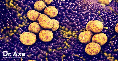 Staph Infection Symptoms Causes Natural Treatments