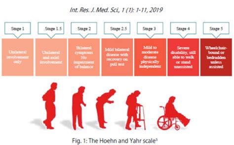 Ms Progression Chart Stages Of Ms Disability Scale And 60 Off