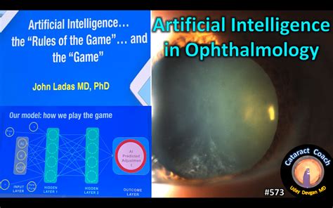 Artificial Intelligence In Ophthalmology Cataract Coach™