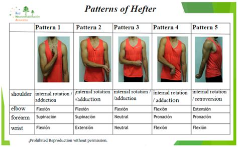 What Is Upper Limb Spasticity Symptoms Causes Treatment