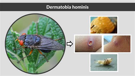 Dermatobia Hominis Identification Behavior And Removal