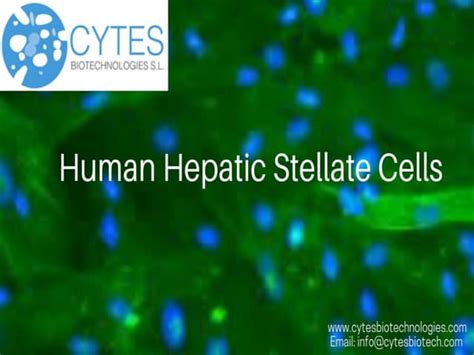 Human Hepatic Stellate Cells Ppt