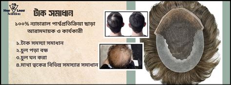 The Hair Clinic Complete Hair Loss Solution চুলপড়ার স্বাভাবিক ধরনঃ আপনার আয়ুষ্কাল কতো