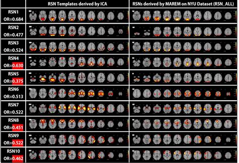 Modeling Functional Brain Networks With Multi Head Attention Based