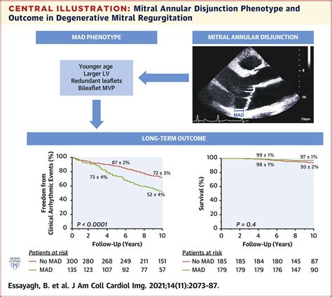 The Mitral Annular Disjunction Of Mitral Valve Prolapse Presentation
