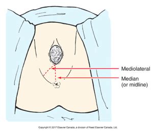 Postpartum Care Flashcards Quizlet