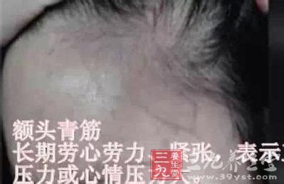 宝宝鼻梁有青筋 健康 孩子 第12页 大山谷图库