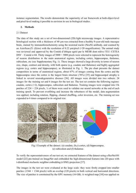 End To End Neuron Instance Segmentation Based On Weakly Supervised