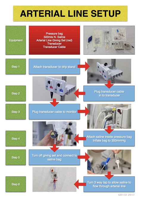St Mungos Arterial Line