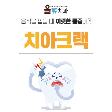 강서올치과 치아 크랙이 생기는 원인은 질기고 딱딱한 음식을 자주 먹거나 수복물 보철물로 인한 경우가