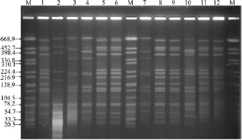 Pfge Profile Of Genomic Dna Of Partial Cperfringens Isolates