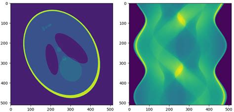 Sinogram Analysis Using Attention U Net A Methodological Approach To Defect Detection And