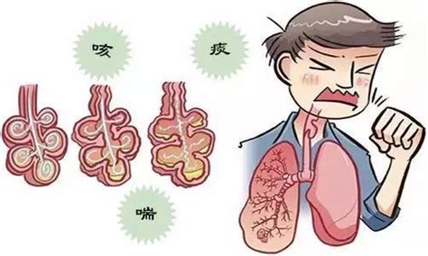 【世界慢阻肺日】让呼吸保持 通畅”！重庆市卫生健康委员会