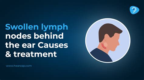 Swollen Lymph Nodes Behind Ear Treatments For Swollen And Enlarged