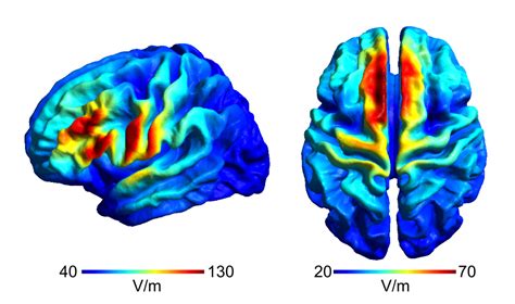Advancing The Application Of Tms In Neurocognitve Research And Beyond