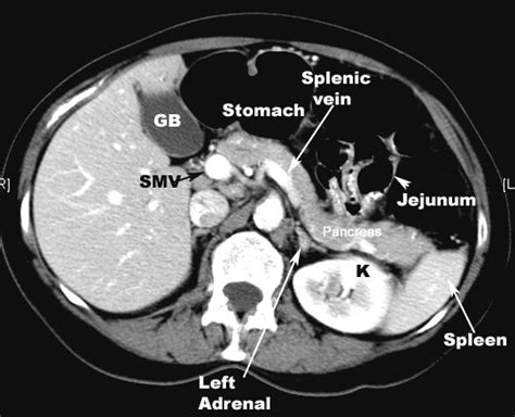 C Segmentation Of The Source Image In Opencv Based On Canny Edge Outline Attained From