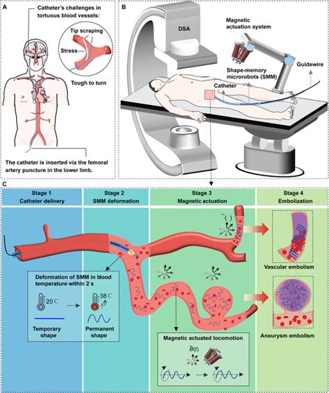 Thermal And Magnetic Dual Responsive Catheter Assisted Shape Memory Microrobots For Multistage