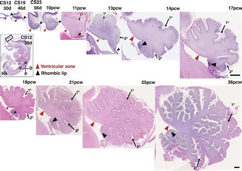 Spatiotemporal Expansion Of Primary Progenitor Zones In The Developing