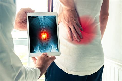 What Are The Best Ways To Decompress Your Spine Dr Stefano
