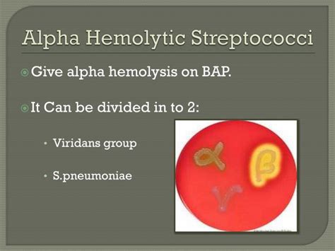 Ppt Streptococcus Powerpoint Presentation Id 2327955