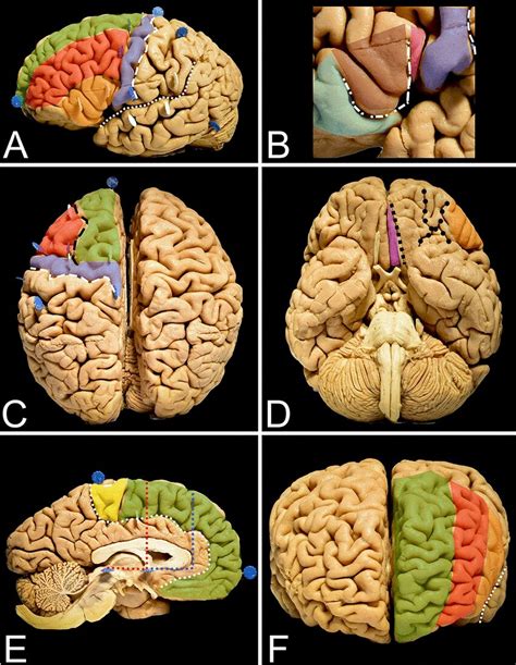 Medical Definition Of Lateral Sulcus At Margaret Bower Blog