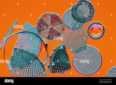 Diatom Diatomeae Diatom From Dunkirk In Maryland Phase Contrast Mri