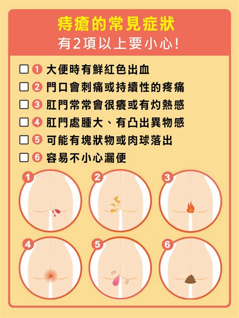 多麗診所 微創痔瘡超音波刀