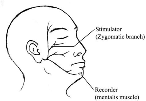 Facial Nerve Schematic