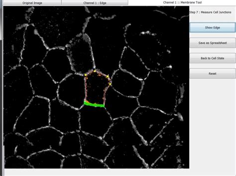 Junction Mapper Is A Novel Computer Vision Tool To Decipher Cell Cell Contact Phenotypes