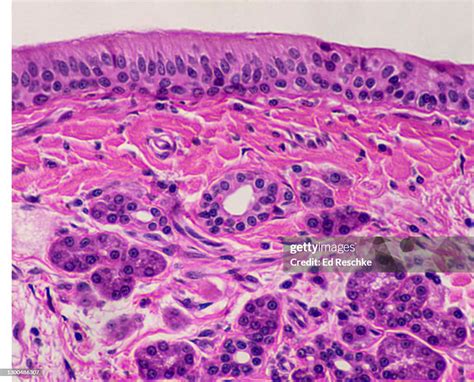 Olfactory Epithelium On The Surface Of The Superior Nasal Concha Also