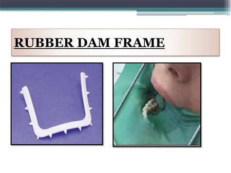 Isolation Types Advantages And Disadvantages Ppt