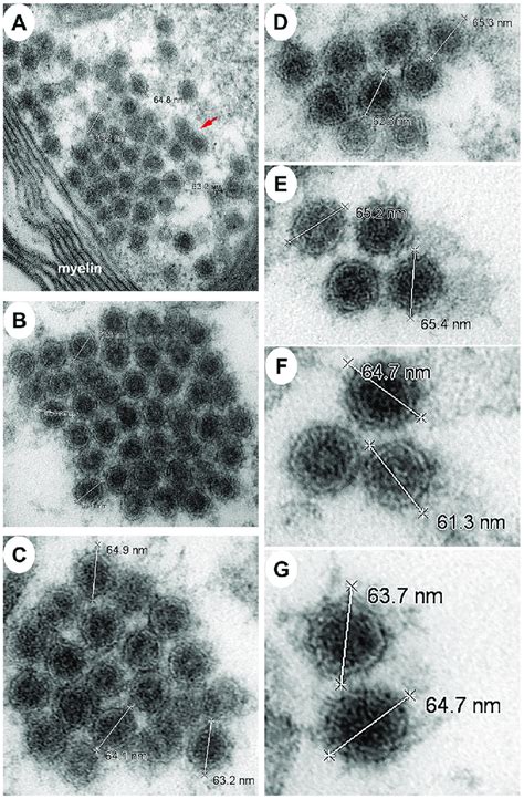The Size Of Extracellular Eeev Virions Via Transmission Electron