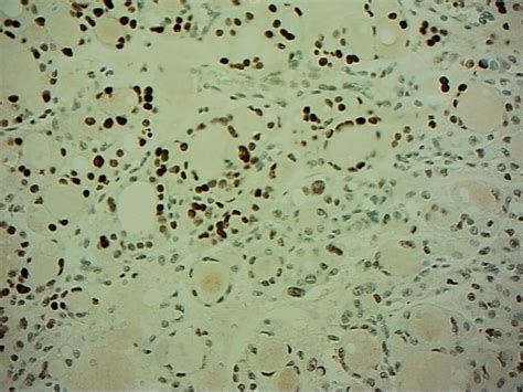 Thy3a Pvptc Niftp Rcpath Document