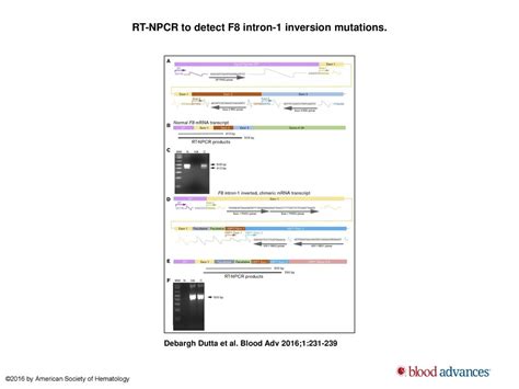 Accurate Simple And Inexpensive Assays To Diagnose F8 Gene Inversion