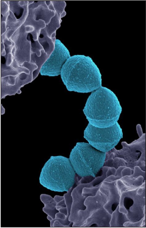 Surge Of Invasive Group A Streptococcus Disease The Lancet Infectious