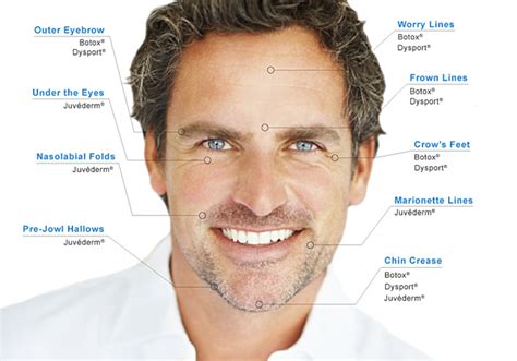 Plastic Surgery Before And After Men Face