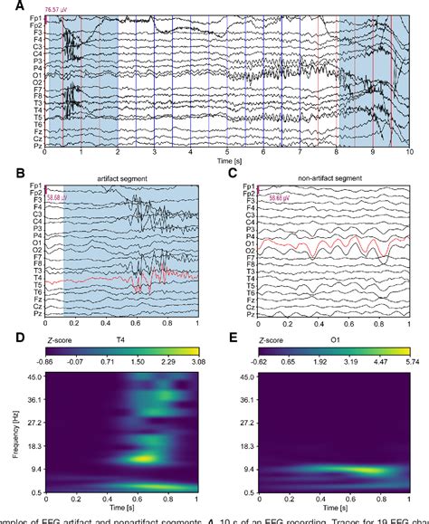 figure 1 from improved manual annotation of eeg signals through