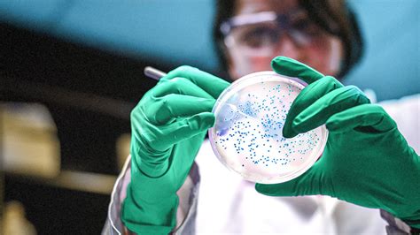 Advanced Cervical Cancer Rates Are Rising Among U S Women Everyday